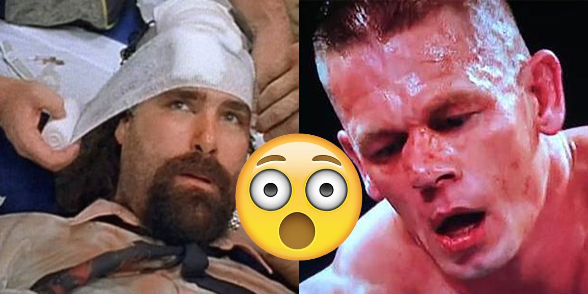 Most Disturbing Pictures of WWE Wrestling Injuries | TheRichest Most Disturbing Pictures of WWE Wrestling Injuries | TheRichest