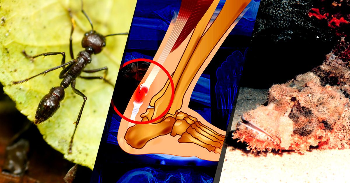 15 Of The Worst Pains Humans Can Feel